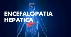 Encefalopatía hepática síntomas tratamiento información - Noticias Médicas