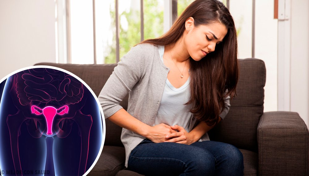 Que es la menorragia, síntomas causas y complicaciones - Noticias Médicas